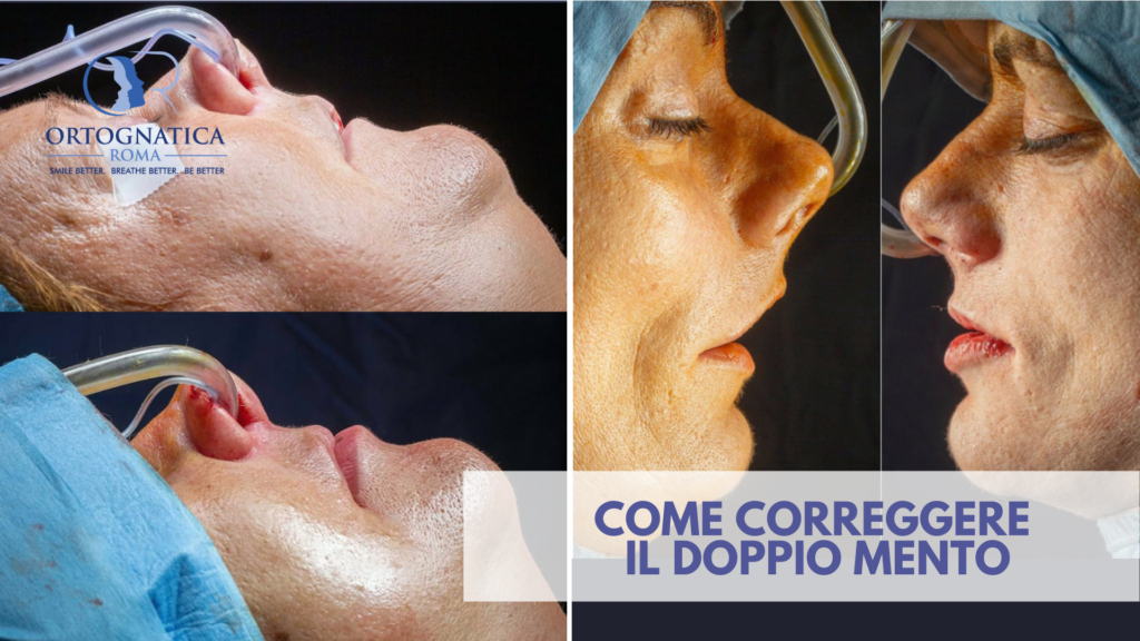 Come eliminare il doppio mento