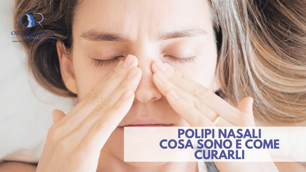 I polipi nasali: cosa sono e come curarli