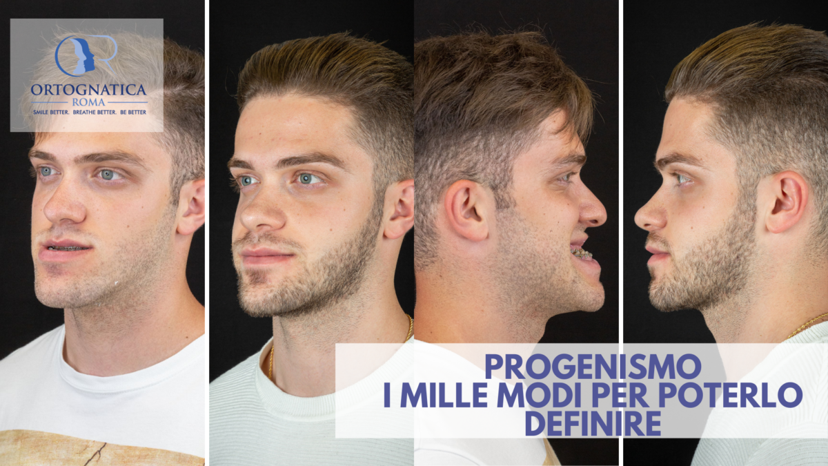 Progenismo: i mille modi per poterlo definire - OrtognaticaRoma