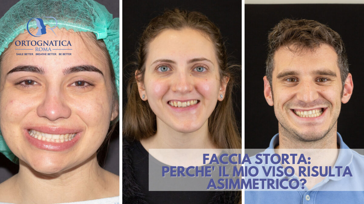 La faccia storta: perché il mio viso risulta asimmetrico? - OrtognaticaRoma